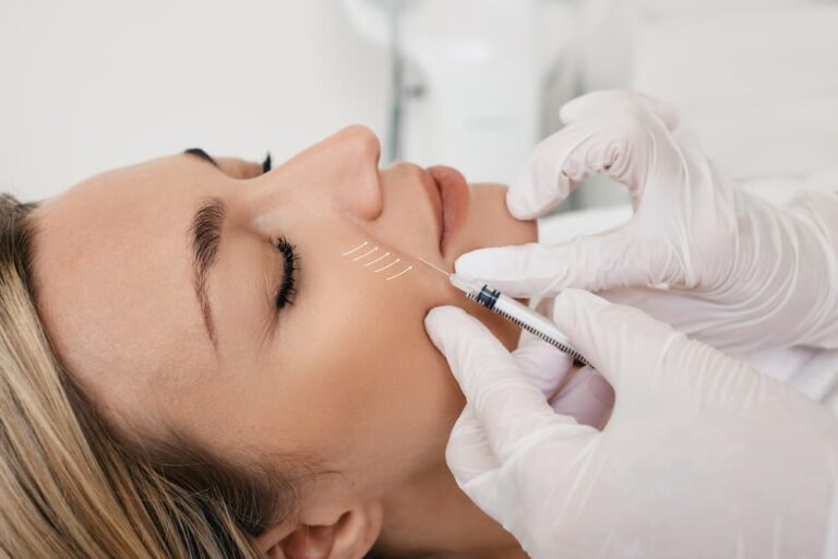 Your Guide to the Best Fillers for Smile Lines - Eastside Eye Candy